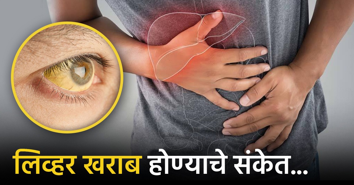चेहऱ्यावर दिसत असतील ही लक्षणं तर समजा खराब होत आहे लिव्हर, लगेच करा हे ...