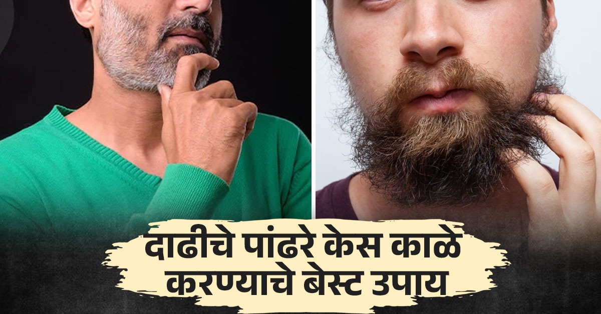 कमी वयातच पांढरे झालेत दाढी-मिशीचे केस? हे घरगुती उपाय करा, मग बघा कमाल ...