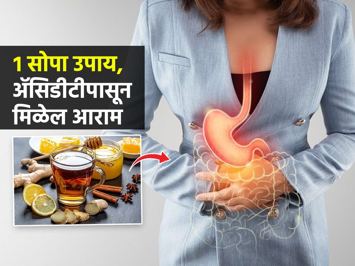ॲसिडीटीमुळे जळजळ, डोकेदुखी होते? त्वरीत आराम मिळवण्याचा १ सोपा घरगुती ...