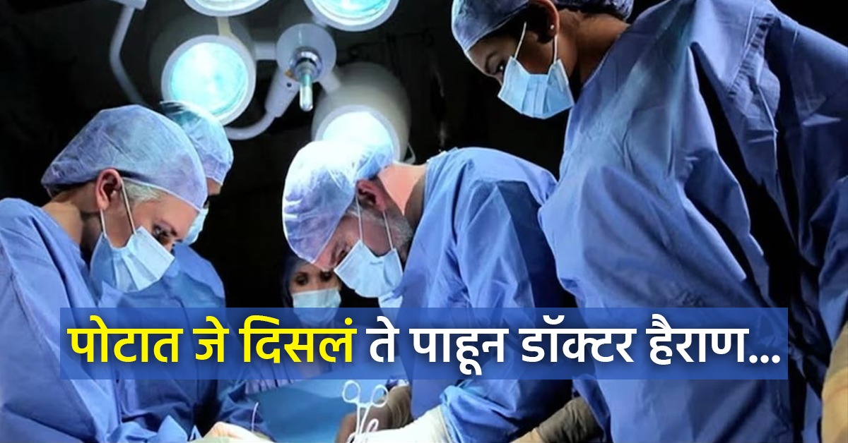 कॅन्सरच्या चेकअपसाठी आलेल्या रूग्णाच्या पोटात दिसलं असं काही, बघून ...