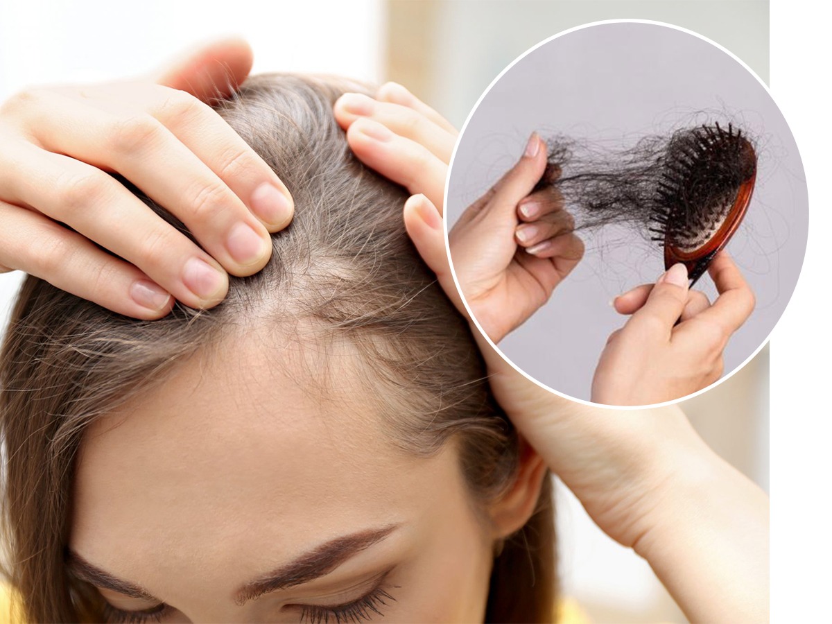 How To Control Hair Fall : केस खूप गळत आहेत, इतके की कापून टाकावेसे ...