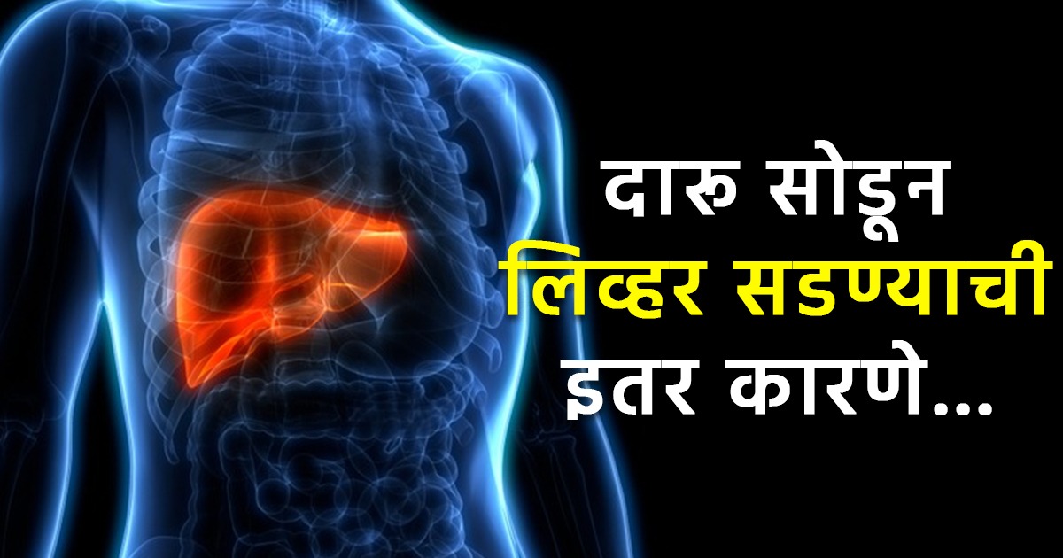 दारूच नाहीतर या गोष्टींमुळेही सडतं लिव्हर, मेडिकल एक्सपर्टने दिला इशारा ...