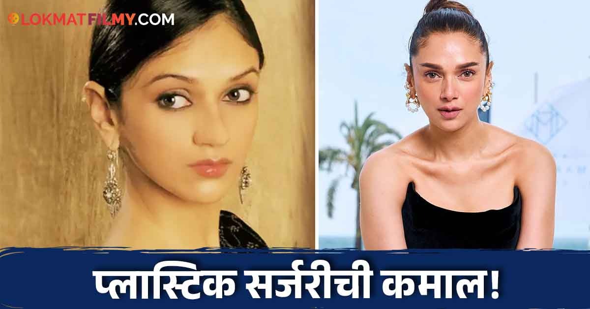 आदिती राव हैदरीनेही केलीये प्लास्टिक सर्जरी? जुना फोटो पाहून चाहते शॉक ...
