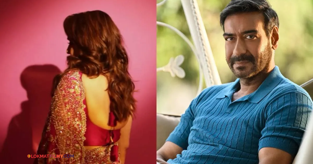 When Ajay Devgn Had A Permanent Burn Mark On His Chin As He Was Lost In ...