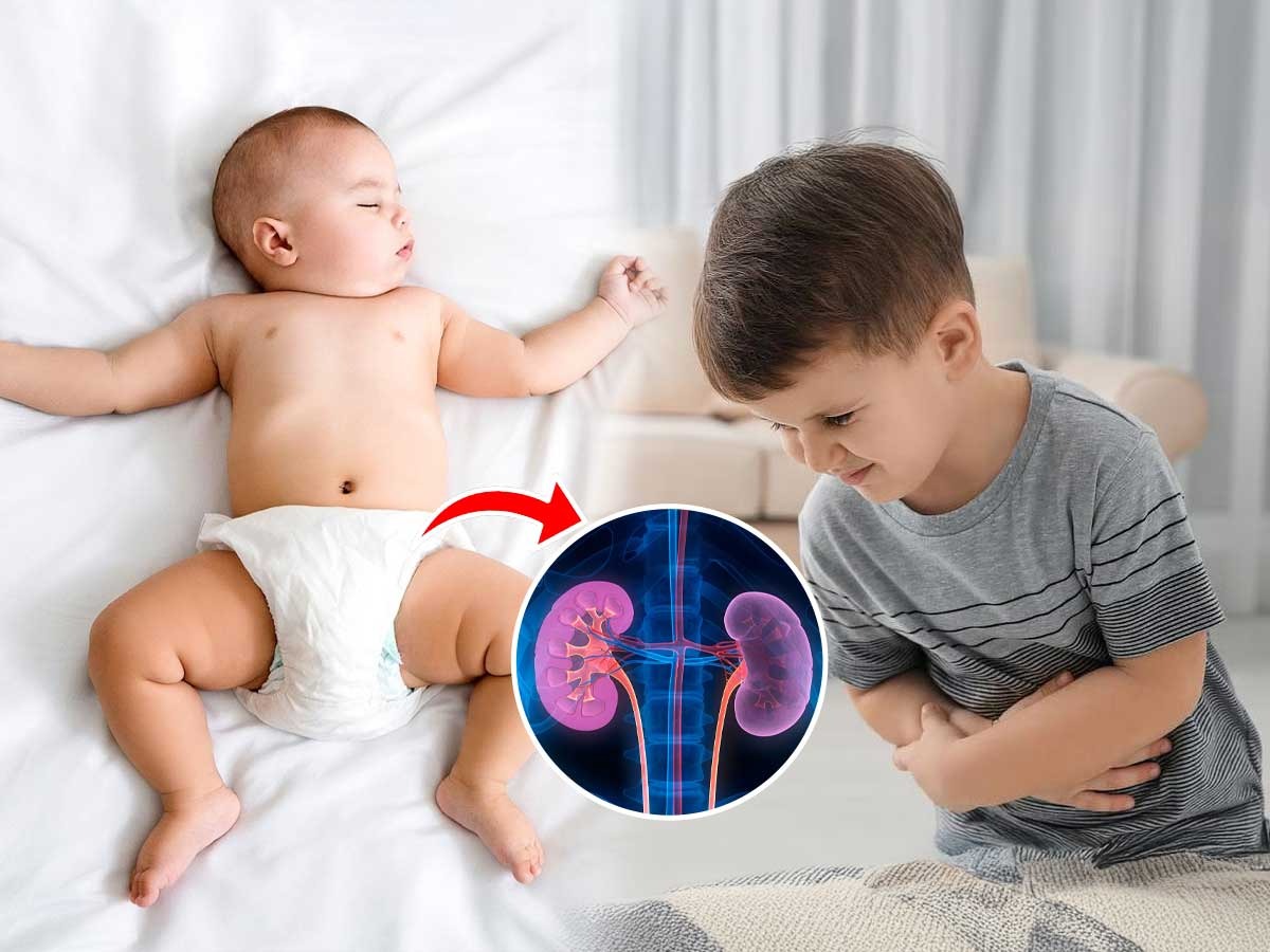 सावधान! बाळाला डायपर लावता? बालरोगतज्ज्ञ सांगतात - होऊ शकतं किडनीचं ...