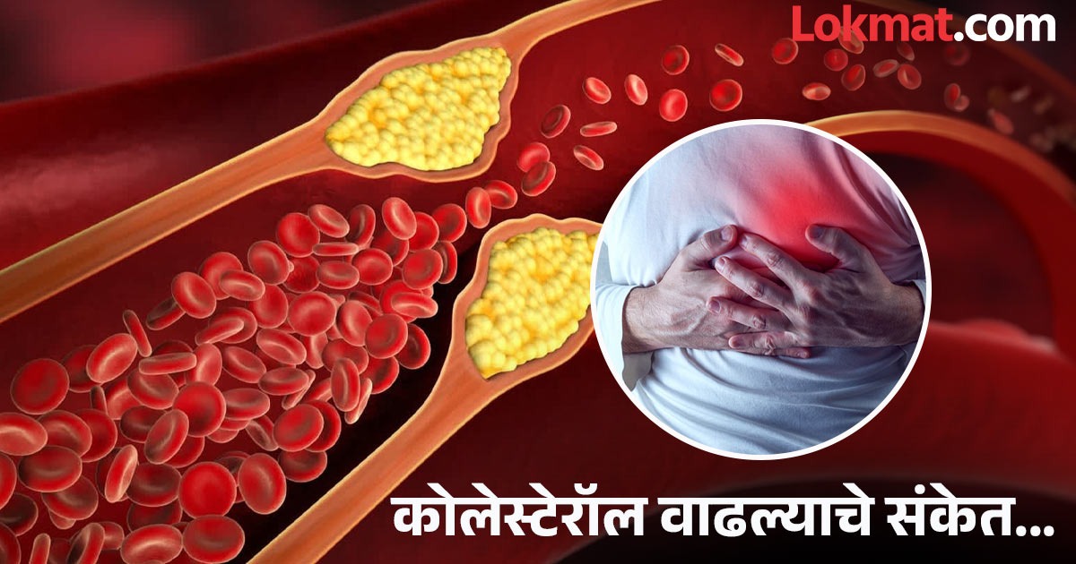 शरीराच्या या अवयवांमध्ये वेदना म्हणजे धोक्याचा इशारा, हाय कोलेस्टेरॉलचा ...