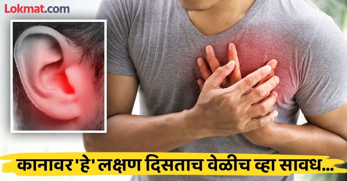 हार्ट अटॅक येण्याआधी कानात दिसू शकतो हा संकेत, दुर्लक्ष करणं पडू शकतं ...
