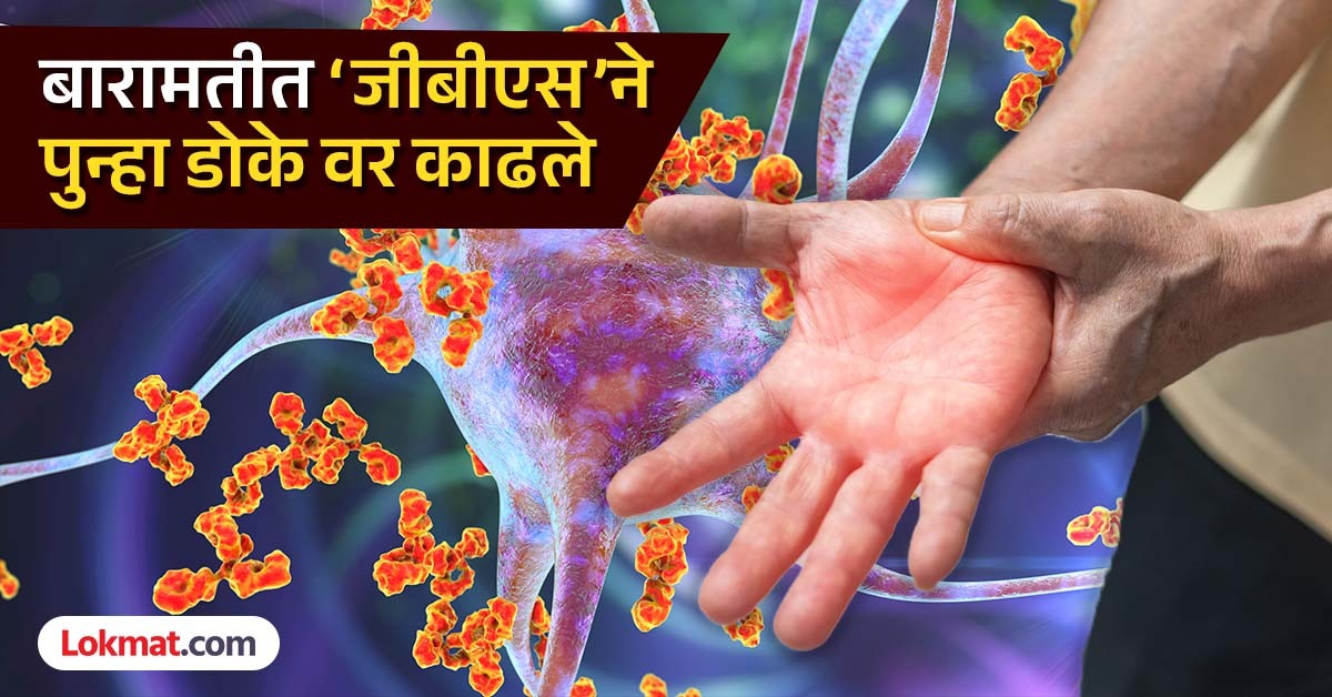 GBS Virus: बारामतीत ‘जीबीएस’ने पुन्हा डोके वर काढले; शहरातील १५ वर्षीय ...