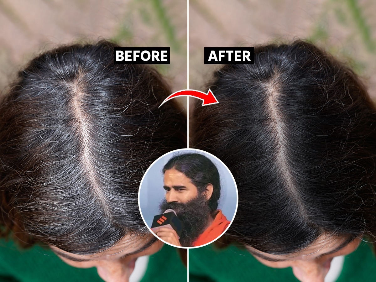 पांढऱ्या केसांमुळे कमी वयातच म्हातारे दिसता? रामदेव बाबा सांगतात केस ...