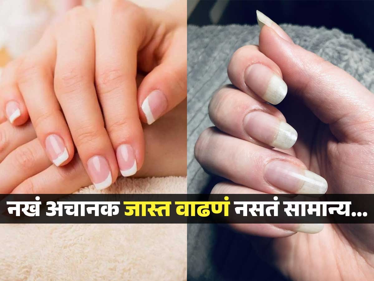 नखं अचानक जास्त वाढू लागली? पाहा हे कोणत्या आजाराचे लक्षण, हातापायाची ...
