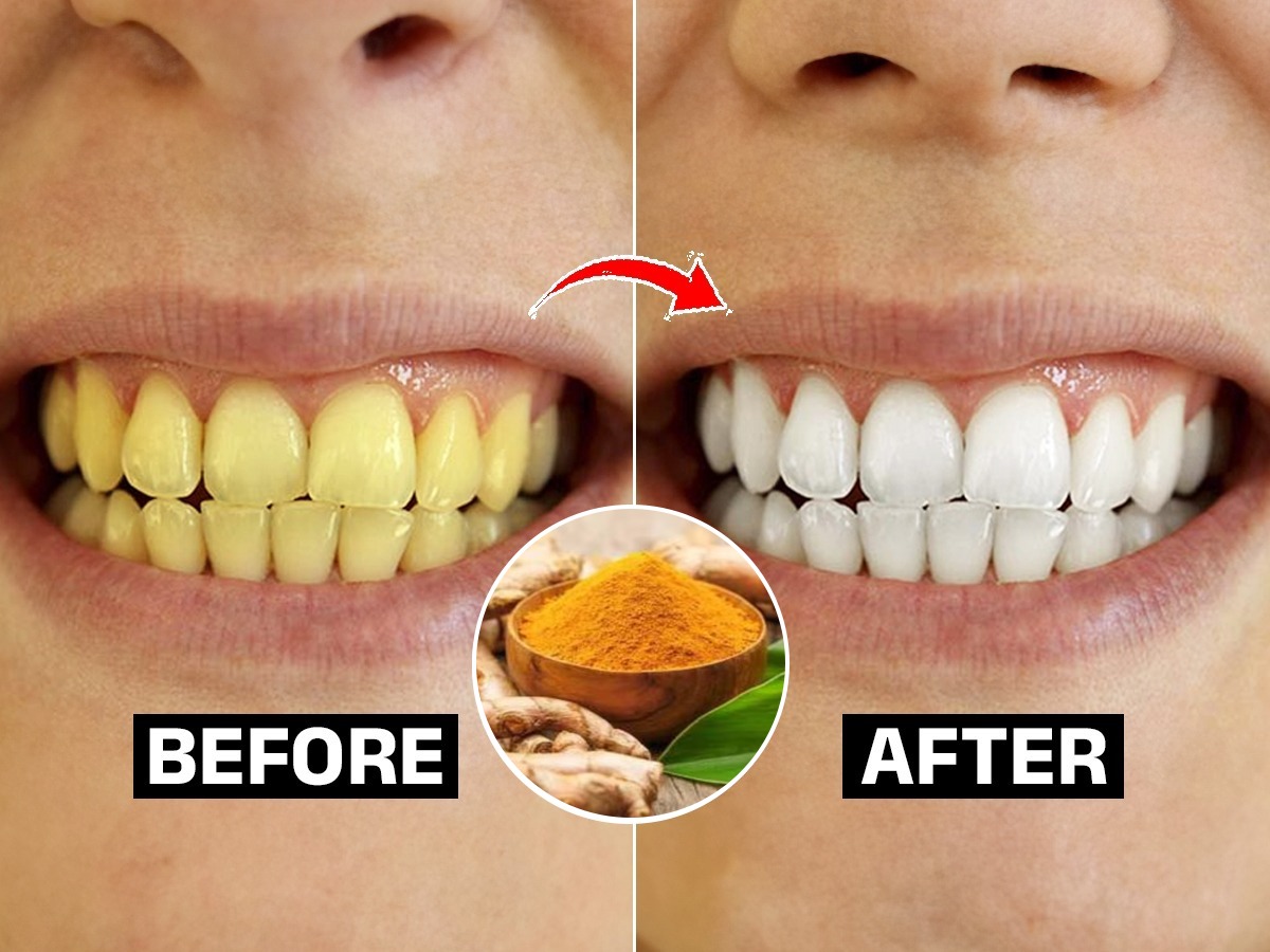 चमकदार दात हवेत तर ‘या’ ४ पदार्थांनी घासा, टूथपेस्टपेक्षाही भन्नाट उपाय ...
