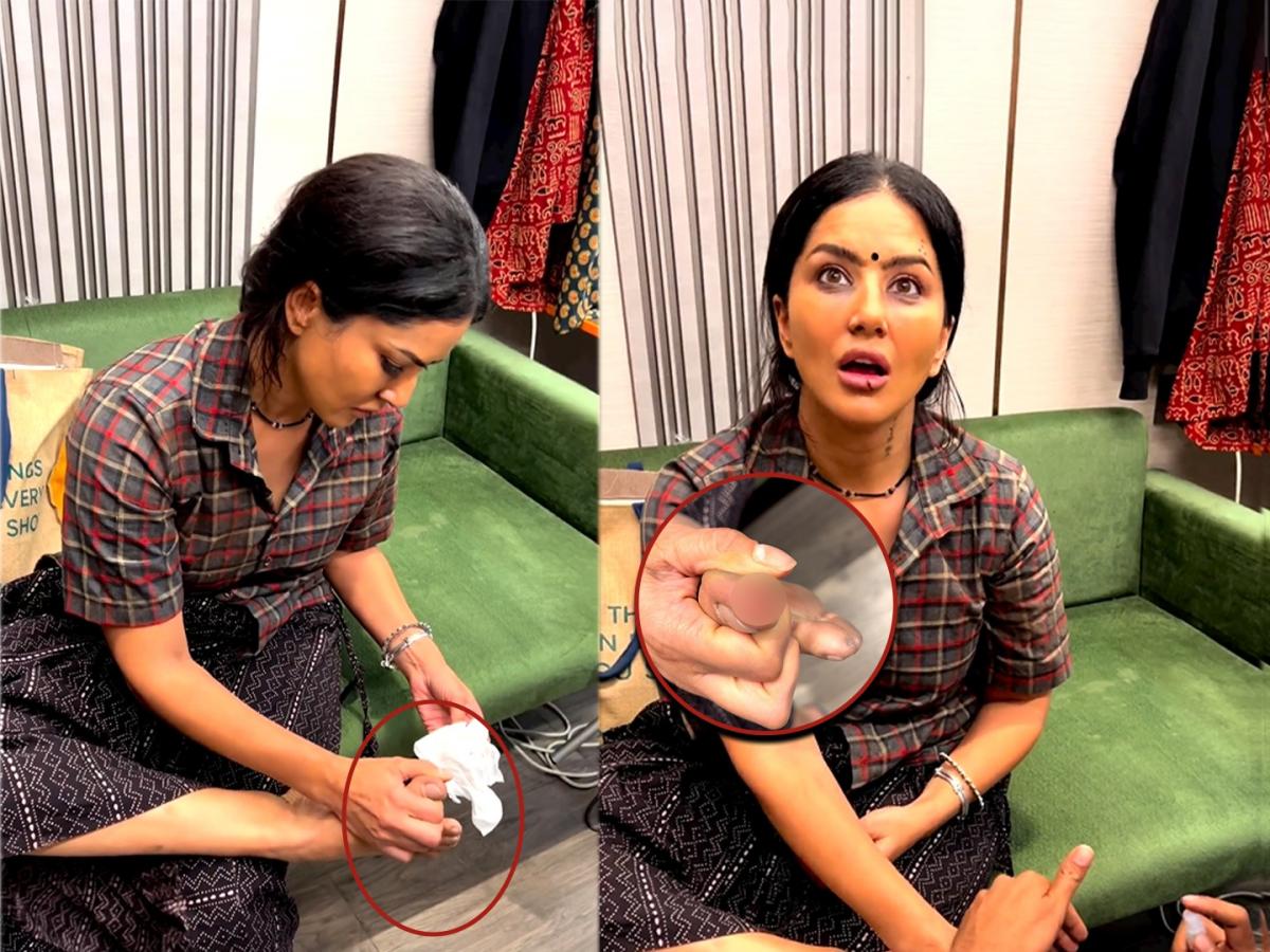 Sunny Leone : अरेरे! शूटिंगदरम्यान सनीच्या पायाला दुखापत, इंजेक्शनलाही ...
