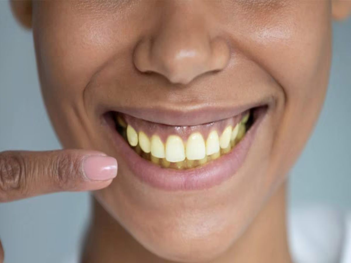 दातांवर पिवळा चिकट थर जमा होतो? रोज ब्रश करतेवेळी ४ गोष्टी करा ...