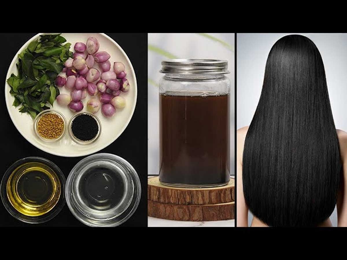 कांदा, कोरफड, कडीपत्ता आहे ना घरात? टक्कल पडण्यापूर्वी त्याचं 'हे' तेल ...