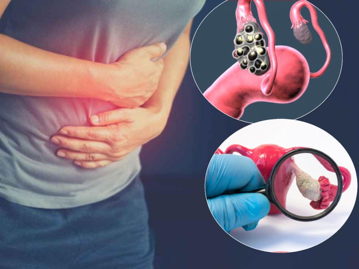 PCOD & PCOS: PCOS मध्ये फर्टिलिटीवर तर PCOD मध्ये पिरिएड्सवर 'असा' होतो ...