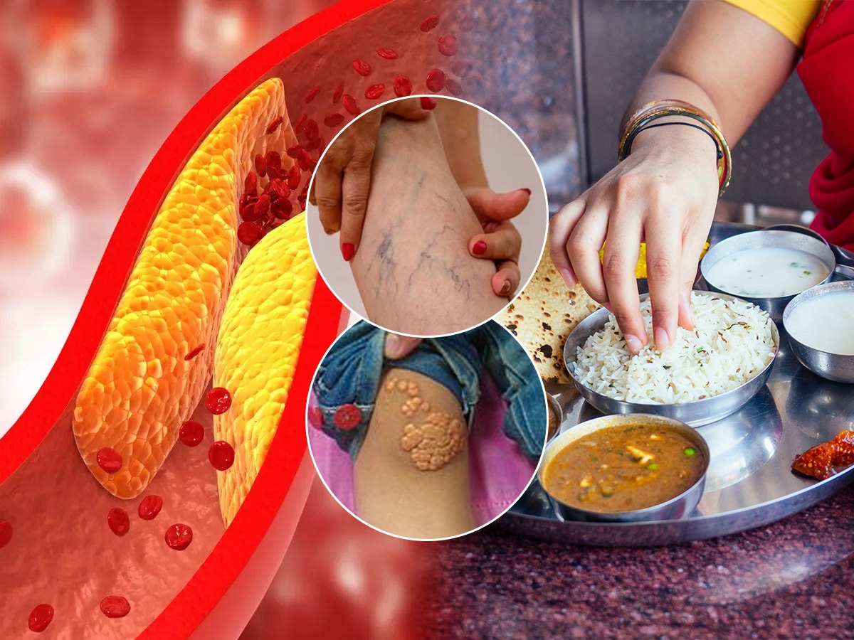 Cholesterol Control Tips : घातक कोलेस्टेरॉल बाहेर काढतील ५ भाज्या; रोज ...