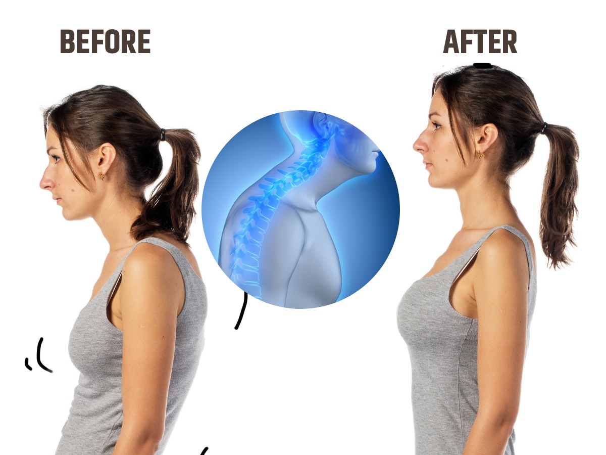 बाक काढून उभे राहता- बसता? १ व्यायाम करून पाहा, बॉडी पोश्चर सुधारण्यास ...