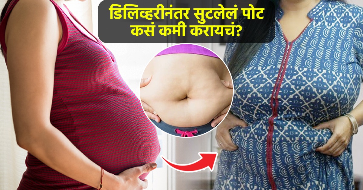 बाळांतपणानंतर सुटलेलं पोट काही केल्या कमीच होत नाही? तज्ज्ञ सांगतात ५ ...