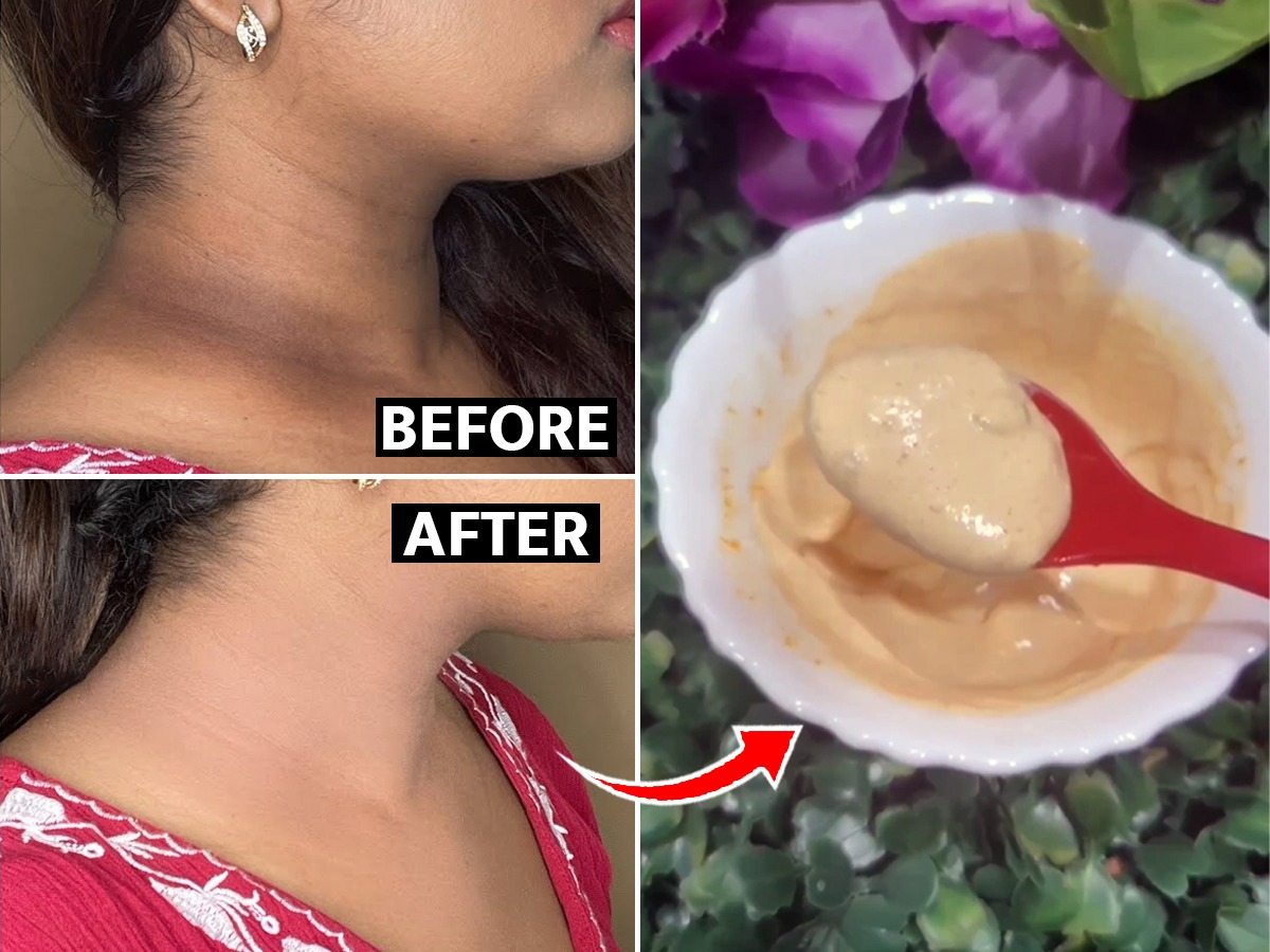 चेहऱ्यापेक्षा मान जास्तच काळी दिसते? १० रूपयांच्या टूथपेस्टची जादू, मान ...