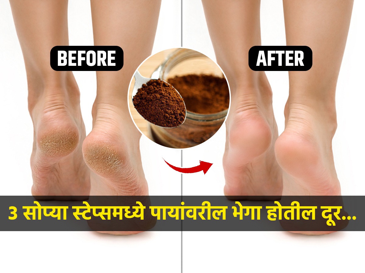 टाचांना भेगा पडल्या ? ३ स्टेप्सचा सोपा उपाय, टाचा होतील कोमल - मऊ आणि ...