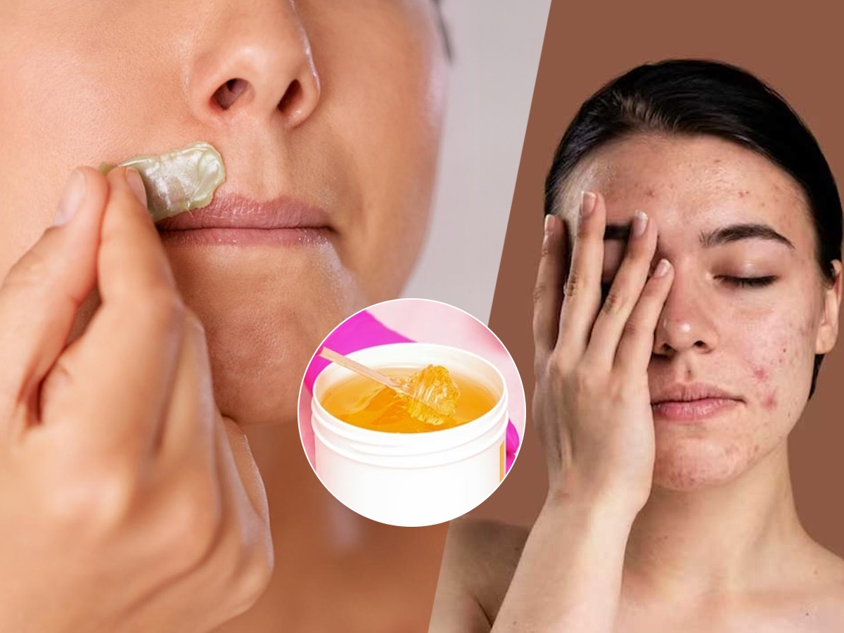 फेस वॅक्सिंग केल्यावर त्वचेची आग होते ? ४ सोपे उपाय, जळजळ - रॅशचा त्रास ...