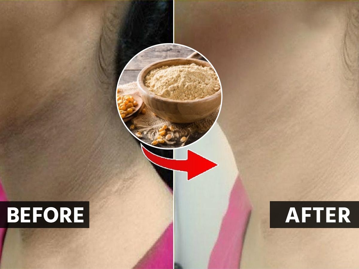 ऐन सणासुदीला मान काळवंडलेली दिसो? चमचाभर बेसनात 'हा' पदार्थ कालवून लावा ...