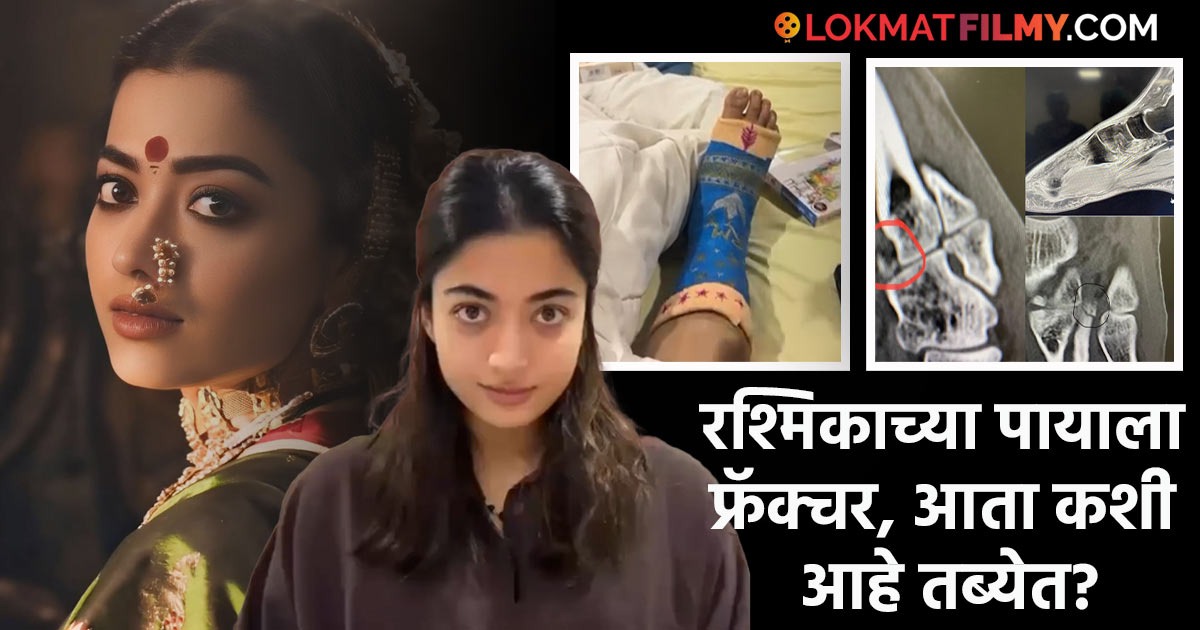 Rashmika Mandanna Share Health Update And Talk About Maharani Yesubai ...
