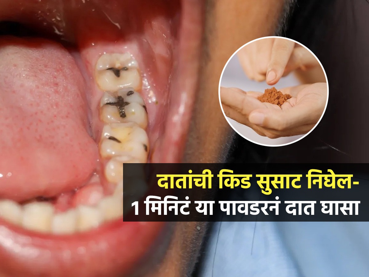 दातांना कीड लागून काळी छिद्रही पडली? ‘या’ पावडरनं १ मिनिट दात घासणं ...
