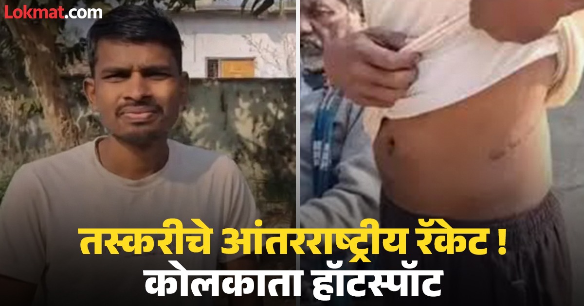 शेतकऱ्याची किडनी प्रकरण बनले आंतरराष्ट्रीय अवयव तस्करीचे जाळे ! स्वतःची ...