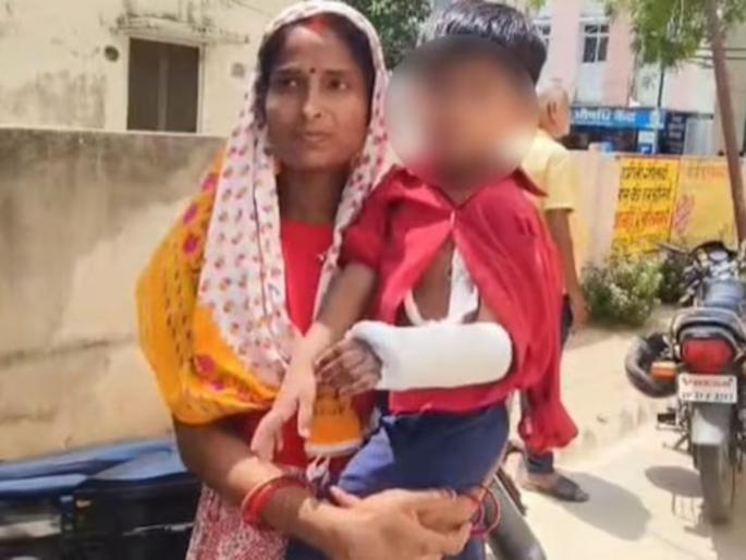 निष्काळजीपणाचा कळस! मुलीच्या उजव्या हाताला दुखापत, डॉक्टरांनी डाव्या ...