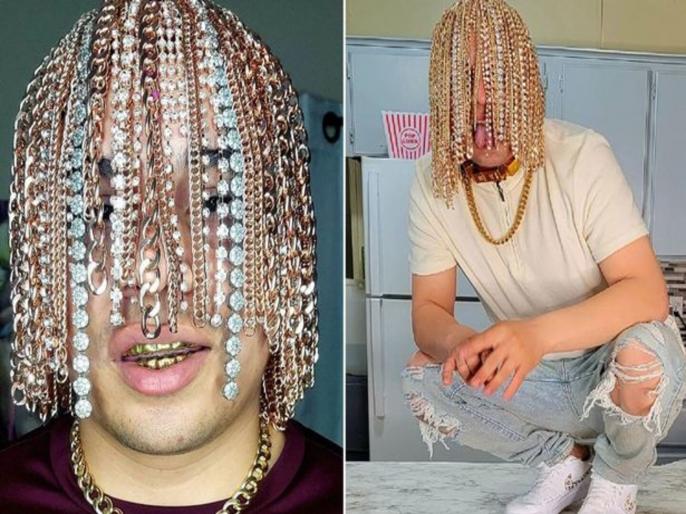 Rapper Dan Sur gets gold chains surgically implanted into his scalp ...