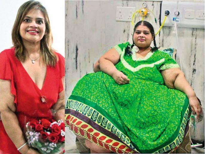 ऐकून धक्का बसला ना..! पण, हे खरंय...महिलेने कमी केले तब्बल २१४ किलो वजन ...