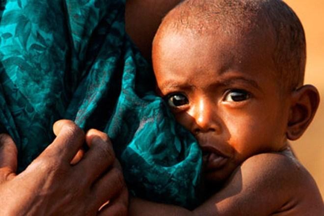 रत्नागिरी जिल्ह्यात २२ तीव्र कुपोषित बालके - Marathi News | 22 severely ...