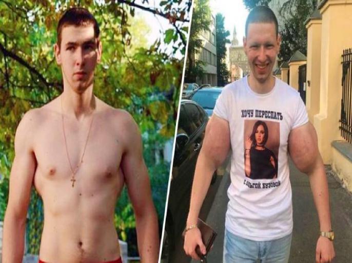 झटपट बॉडी बनवण्याचा नाद जीवावर बेतला; युवकाला भलताच कारनामा नडला ...