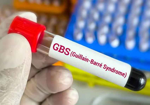 GBS Outbreak: Nashik Reports First Guillain-Barré Syndrome Case; 60 ...