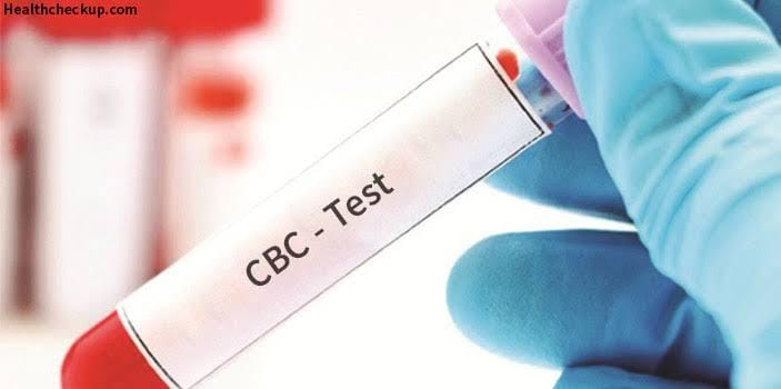 Complete Blood Count (CBC) Test: Purpose, Procedure, Normal Range, and ...