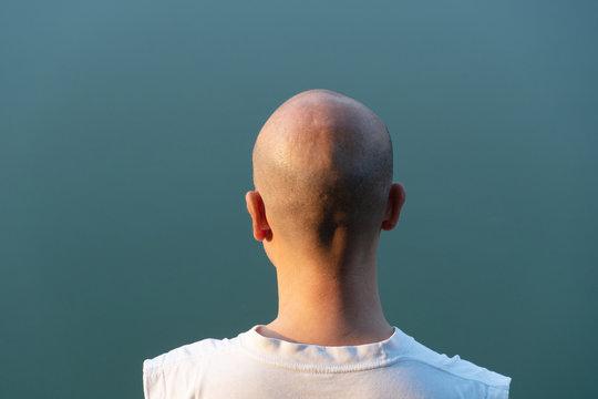 Spain Tops Global List of Bald Men With 44.50% of Population Affected ...