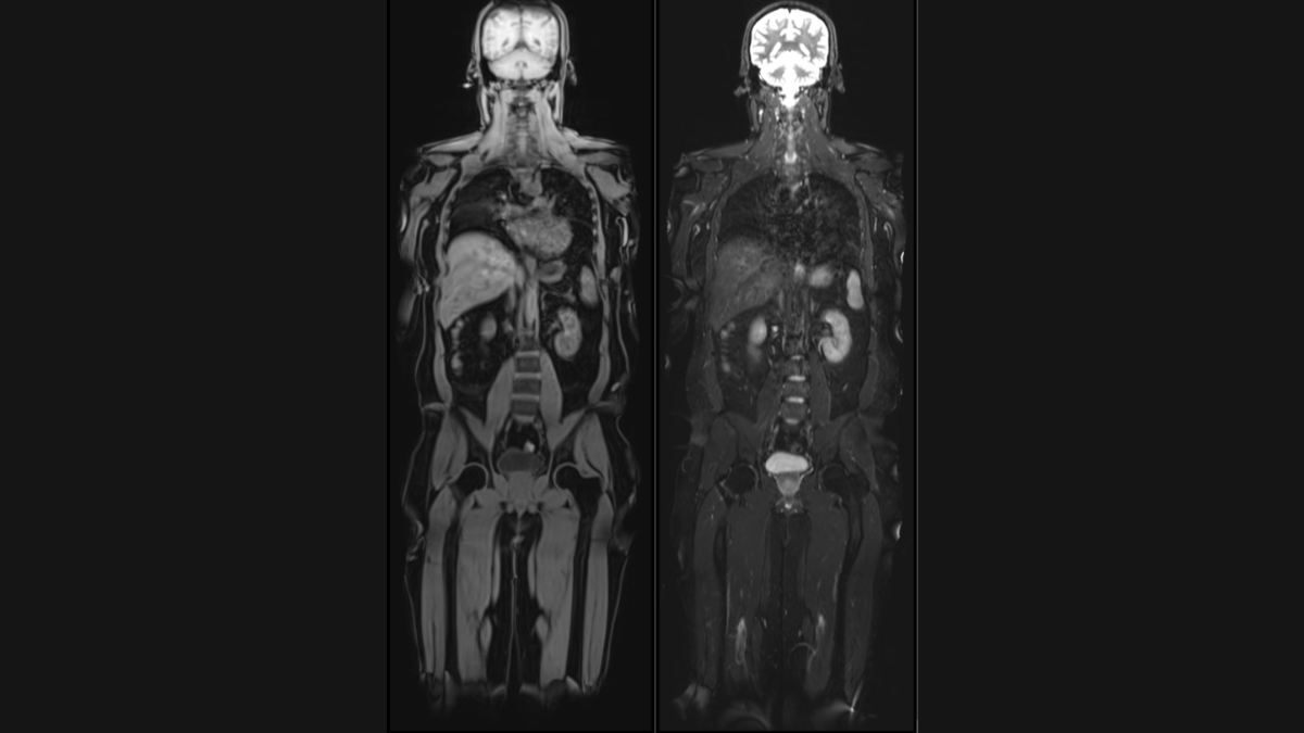 Aarthi Scans and Labs Launches ‘Vital MRI’: A New Chapter in Preventive ...